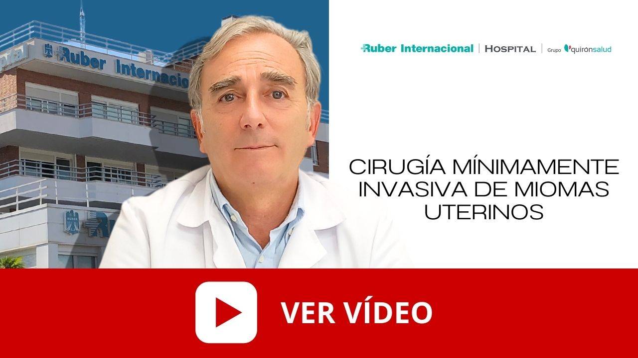 Miomas uterinos: síntomas, diagnóstico y tratamientos avanzados